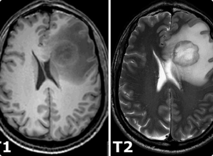 Showcase | Meta Open Source